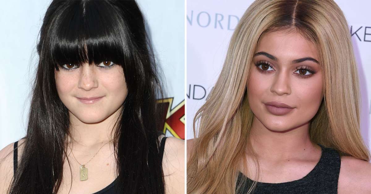 Kylie Jenner razkrila, zakaj si je povečala ustnice! Kylie Jenner razkrila, zakaj si je povečala ustnice!