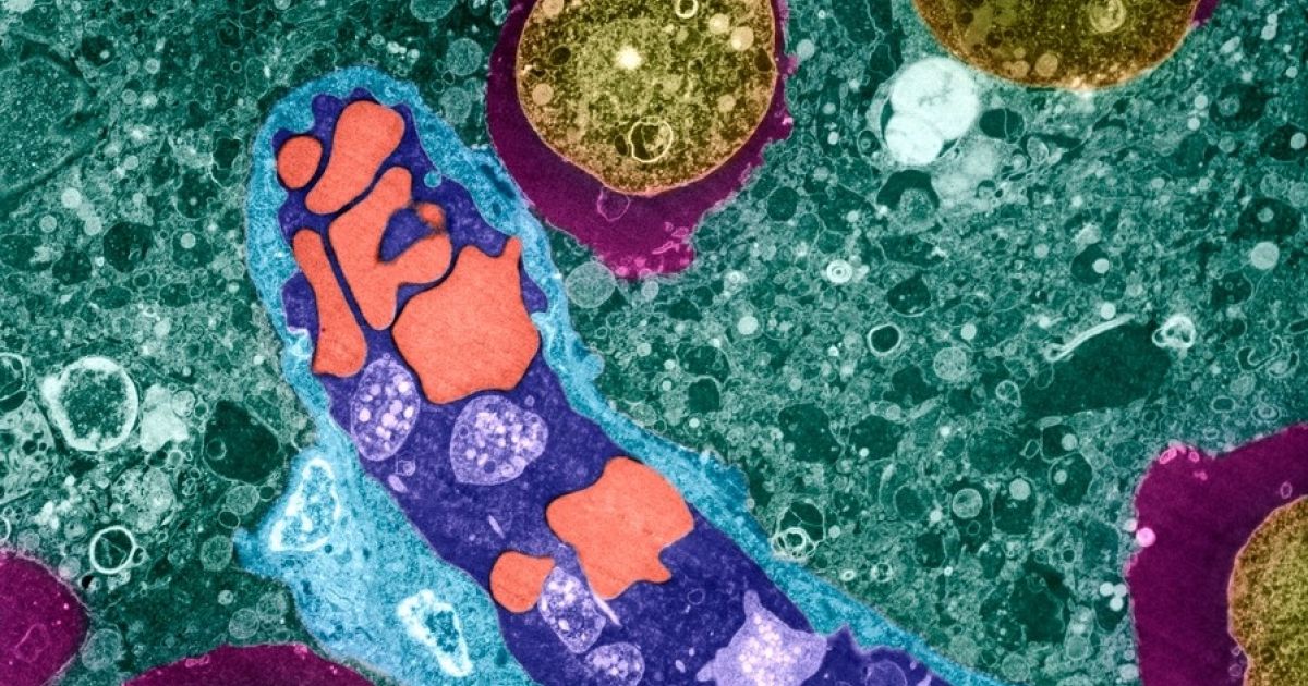 Staknil amebo, ki se prehranjuje s človeškimi možgani - Svet24.si