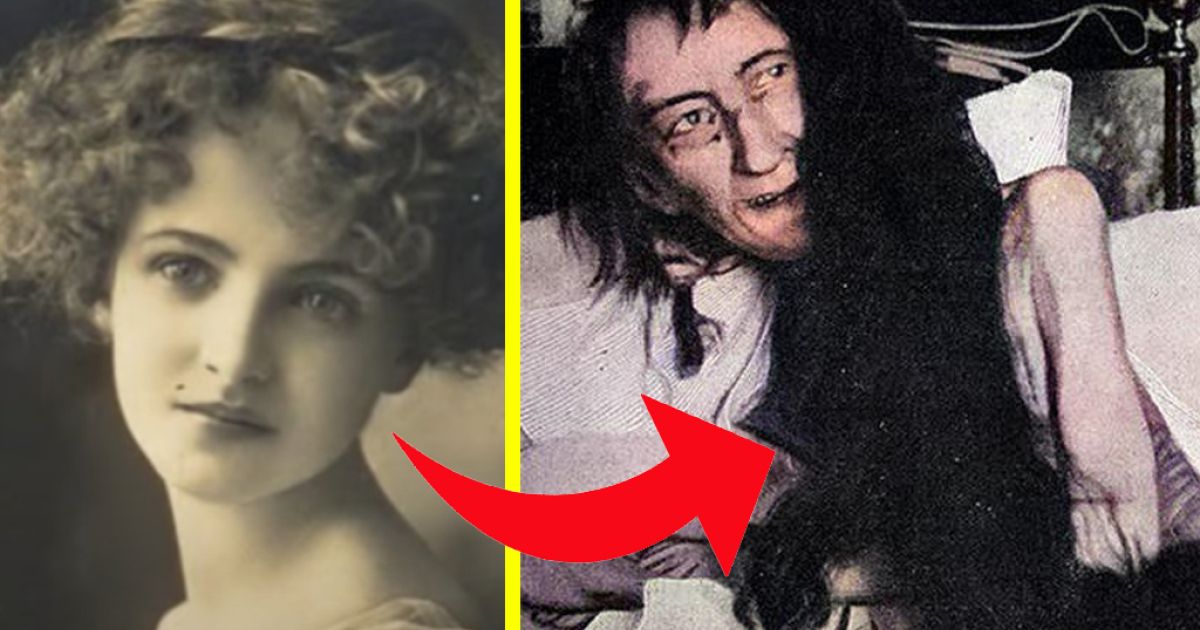 Grozljivo! Mati jo je 25 let skrivala v sobi, v smradu med podganami ...