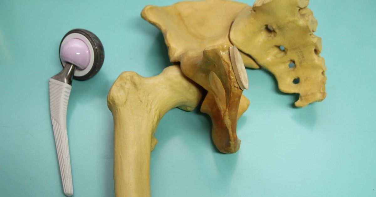 Arbor mea: Gregor Kavčič je čakalne dobe krajšal, ne pa daljšal - Svet24.si